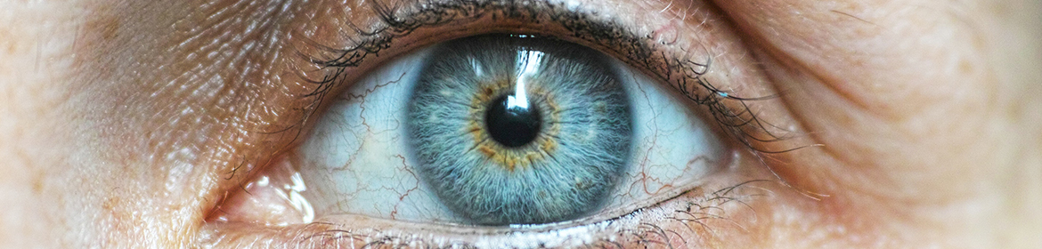 Qu’est-ce qui cause les yeux rouges ? Symptômes, traitements et moyens ...