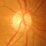 Guide pratique de l’anatomie de l’œil - Lensblog-FR